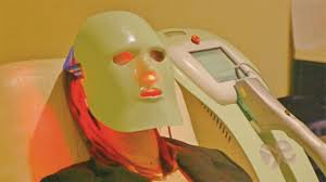 IPL (INTENSE PULSED LIGHT) AND MEIBOMIAN GLAND EXPRESSION | Thompson ...